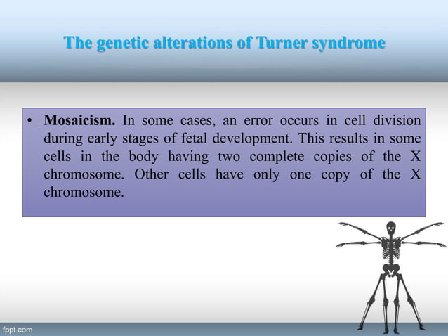 TURNER SYNDROM and causes any type sign symptoms | PPT
