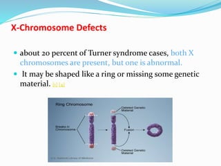 Turner syndrome | PPT