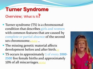 Turner syndrome | PPT