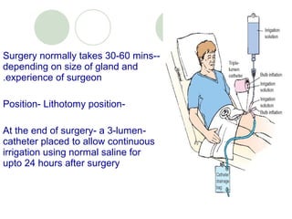 Turp | PPT