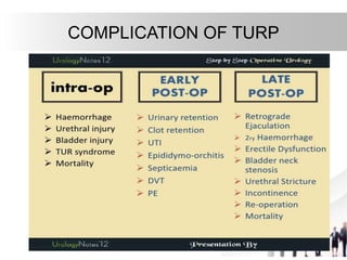 Transurethral resection of the prostate (TURP) | PPTX | Digestive ...