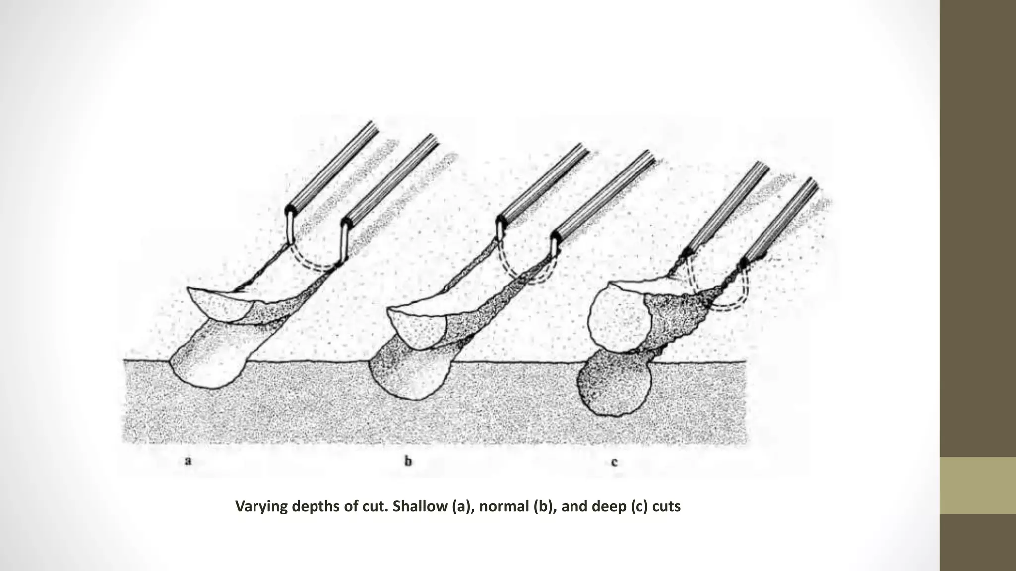 TURP TECHNIQUE | PPTX