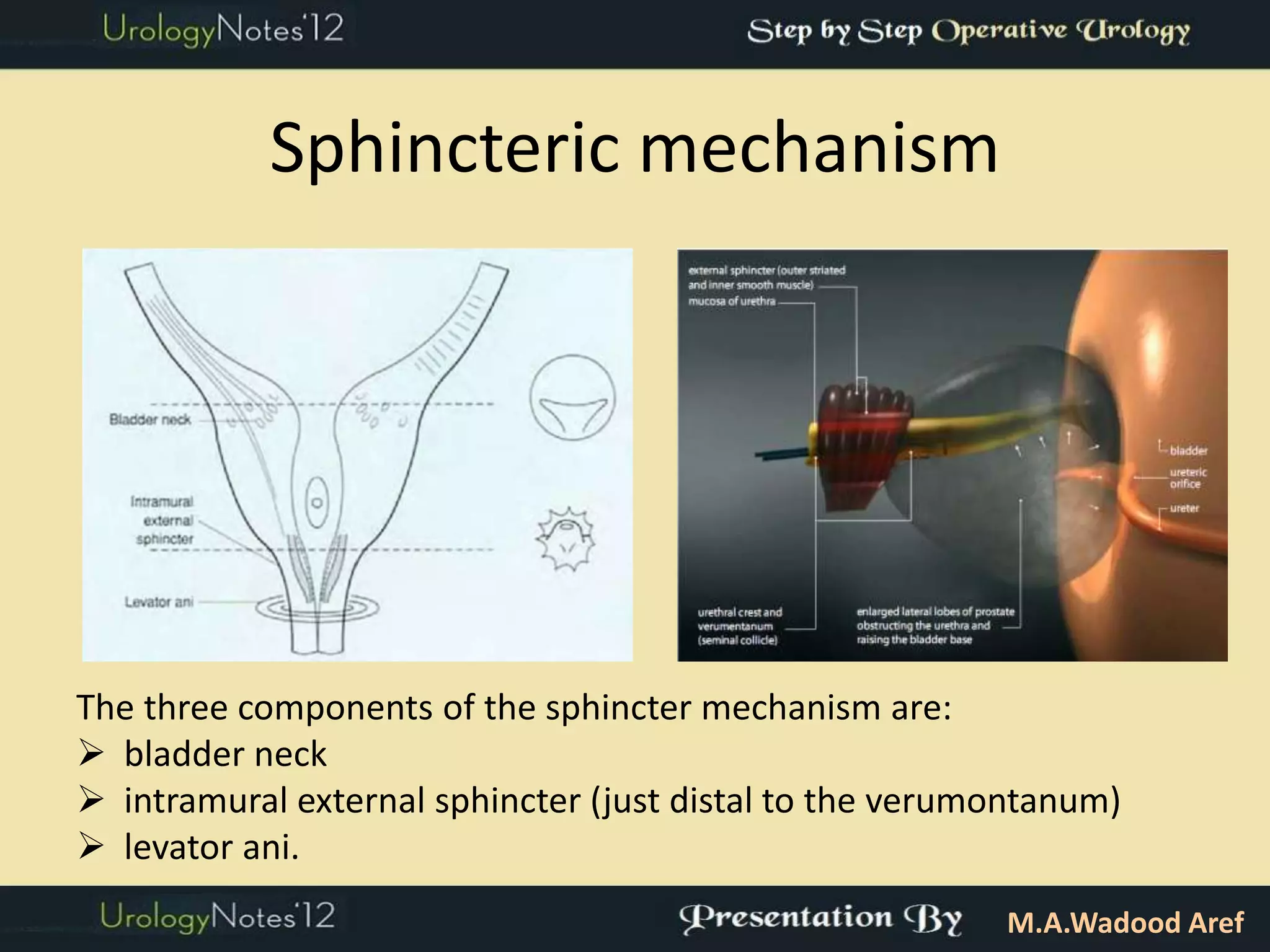 TURP step by step operative urology | PDF