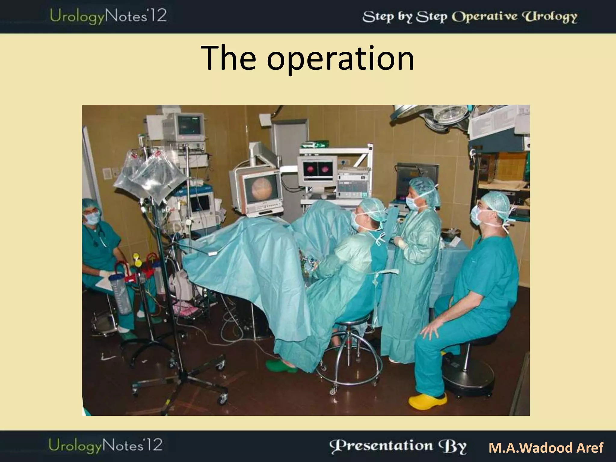 TURP step by step operative urology | PDF