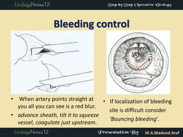 TURP step by step operative urology | PDF | First Aid | Injuries