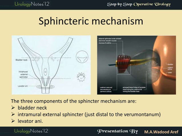 TURP step by step operative urology | PDF | First Aid | Injuries