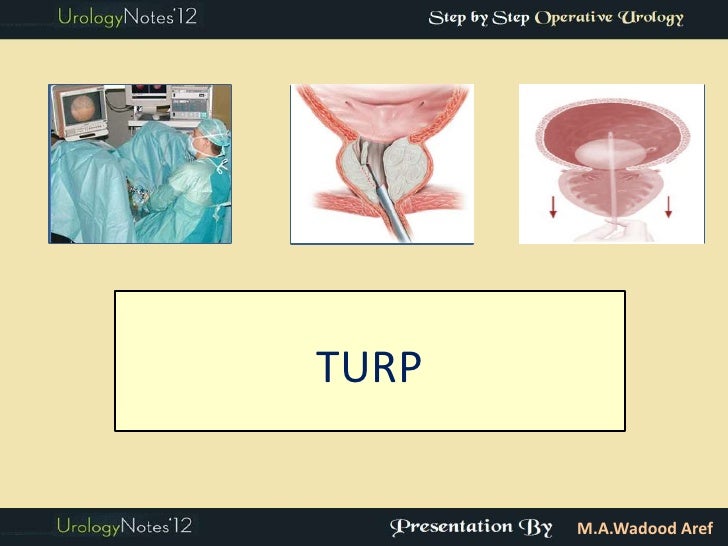 TURP step by step operative urology
