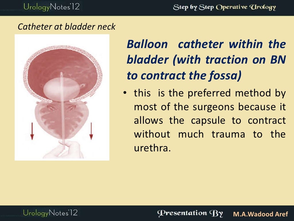 TURP Step By Step Operative Urology turp-step-by-step-operative-urology