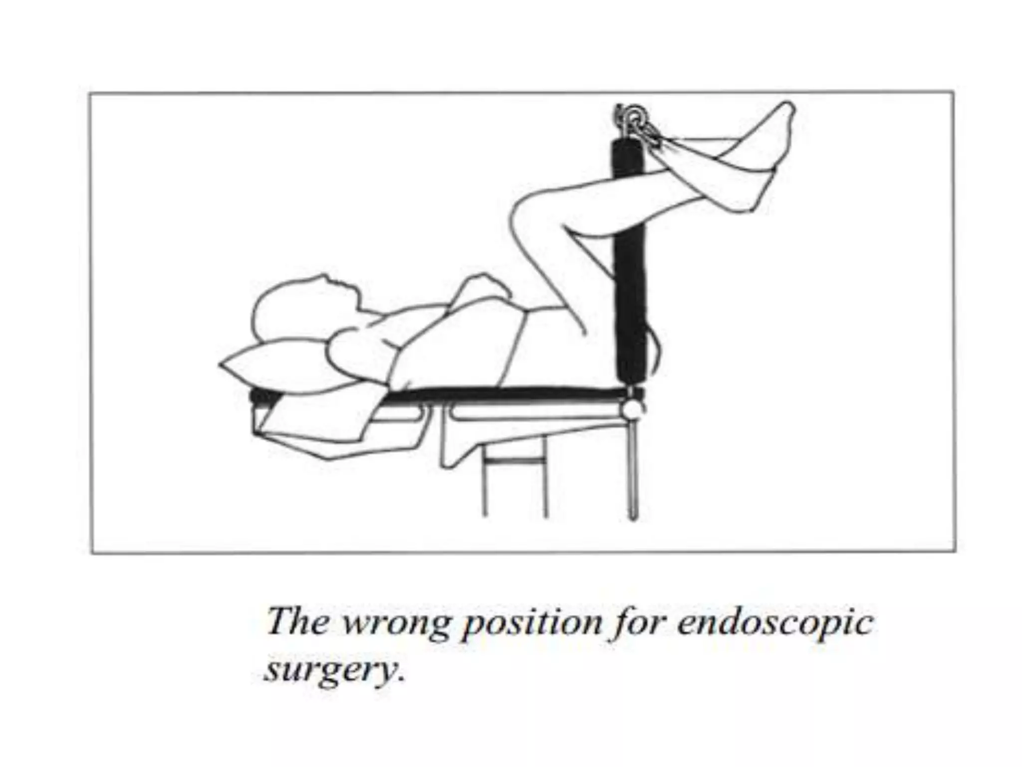 Turp techniques | PPTX