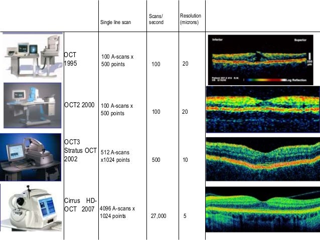 Optical coherence tomography definition - qerypub