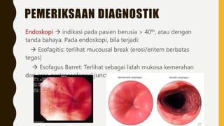 TUTKLIN_GERD_YULIA WIDIASTUTI.pptx