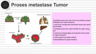 pembahsan kasus tumor metastasis pada rahang | PPTX