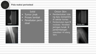 pembahsan kasus tumor metastasis pada rahang | PPTX