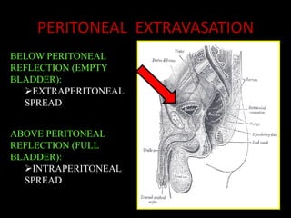Tutorial bladder trauma | PPTX