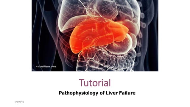 Liver Failure | PPT | Free Download