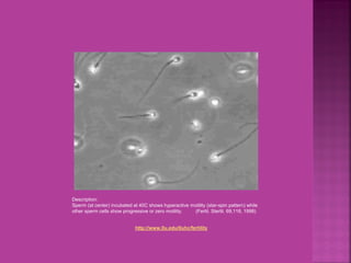 Infertility And Its Management | PDF