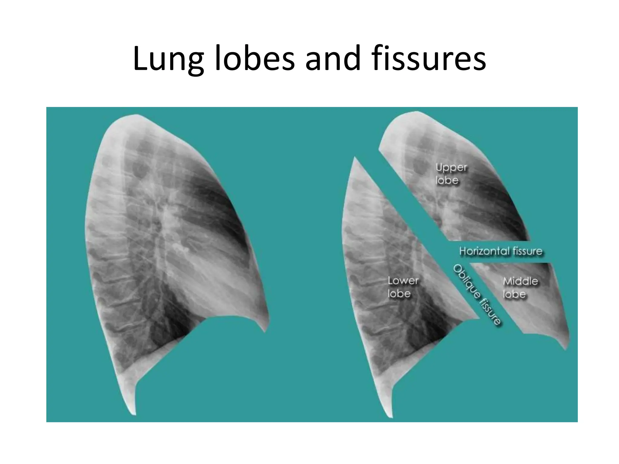 Chest X-Ray Anatomy. | PPTX