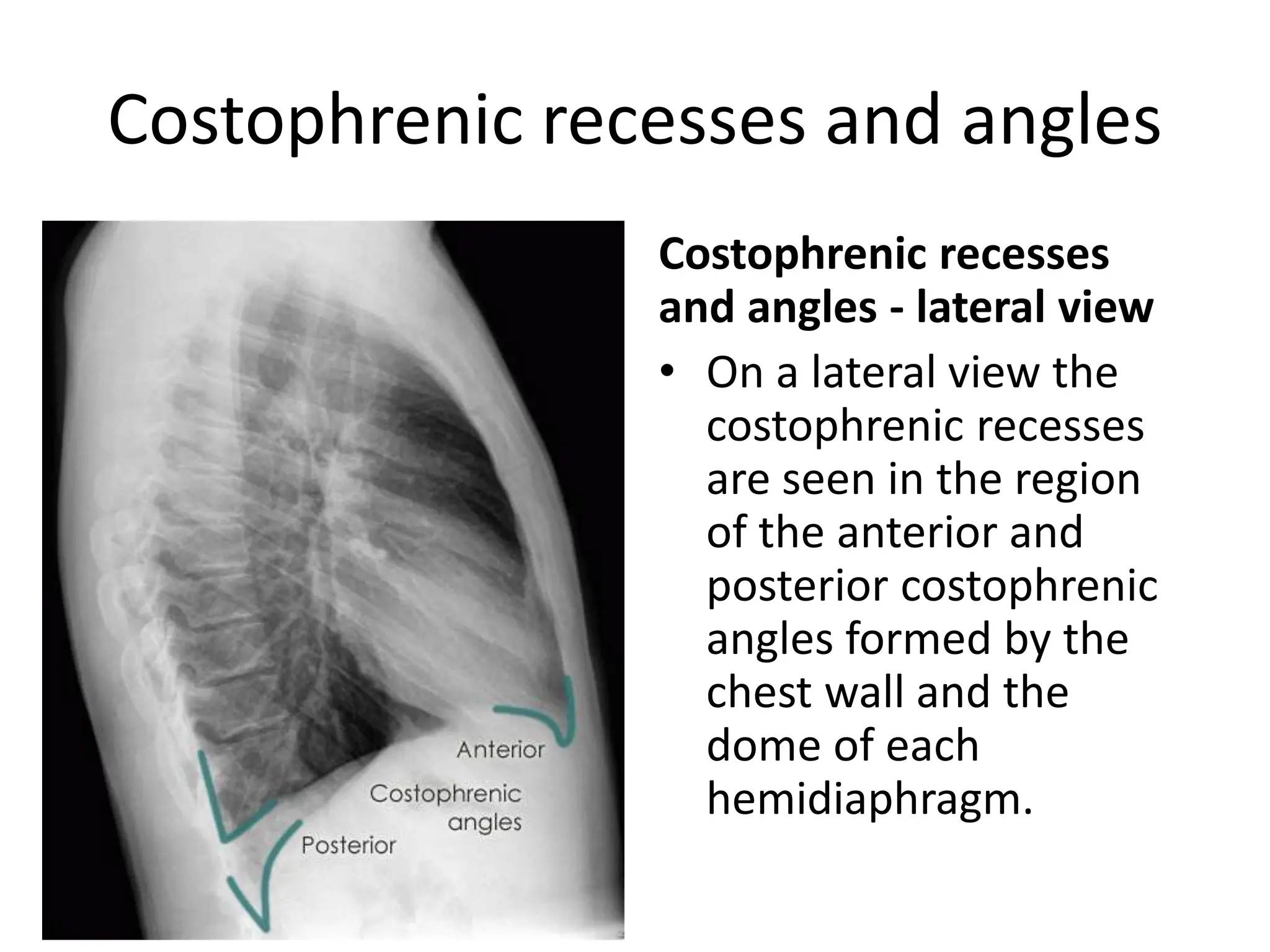 Chest X-Ray Anatomy. | PPTX