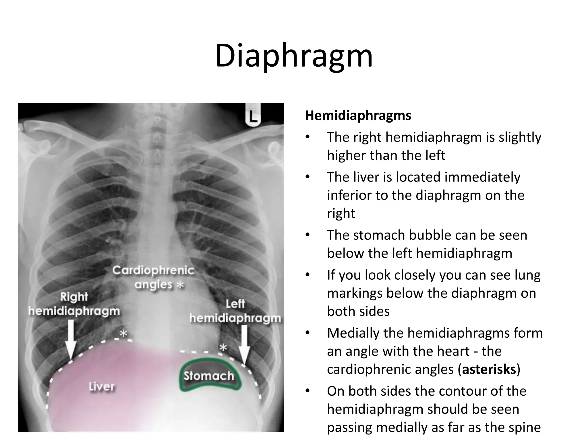 Chest X-Ray Anatomy. | PPTX