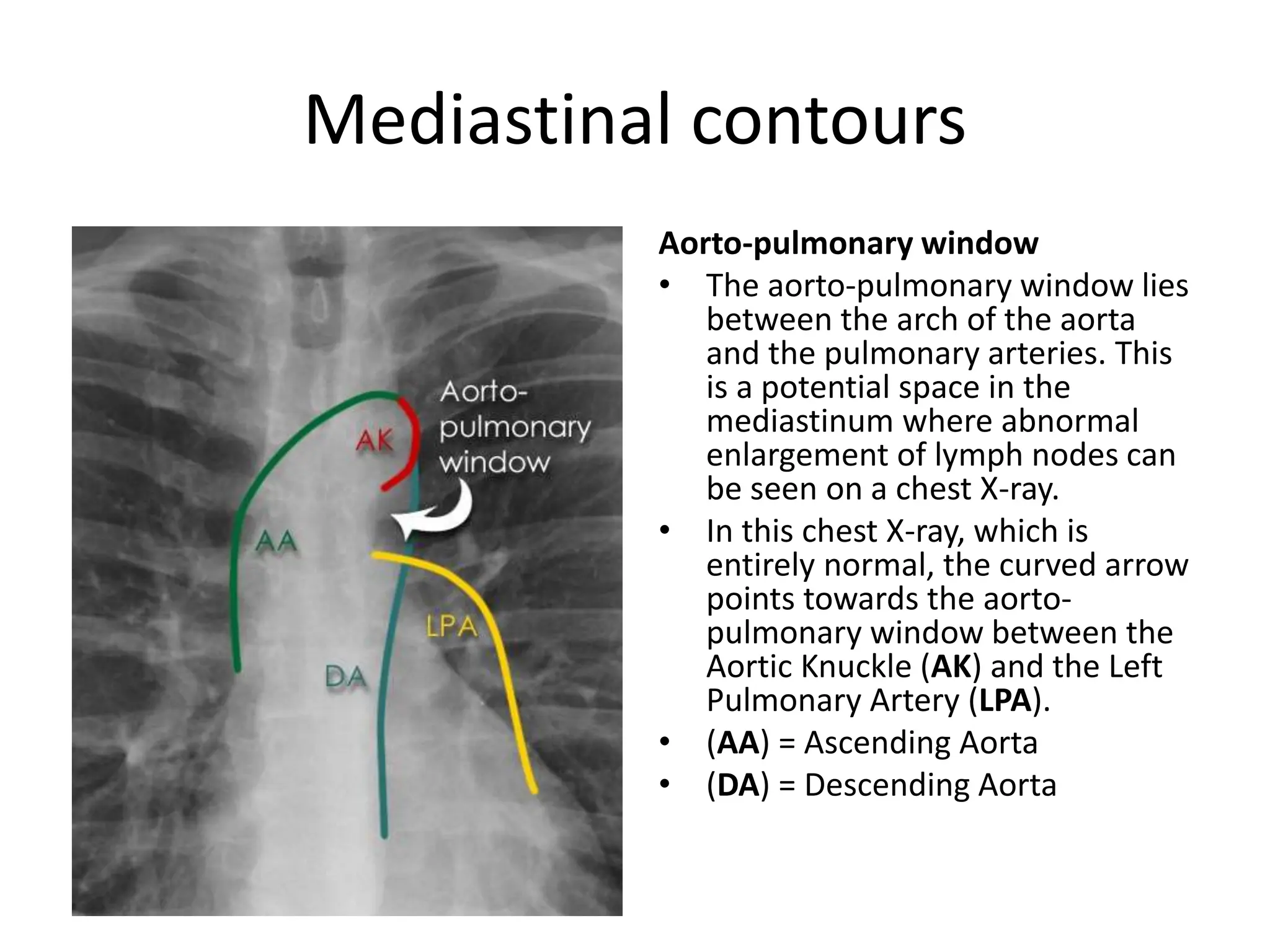 Chest X-Ray Anatomy. | PPTX