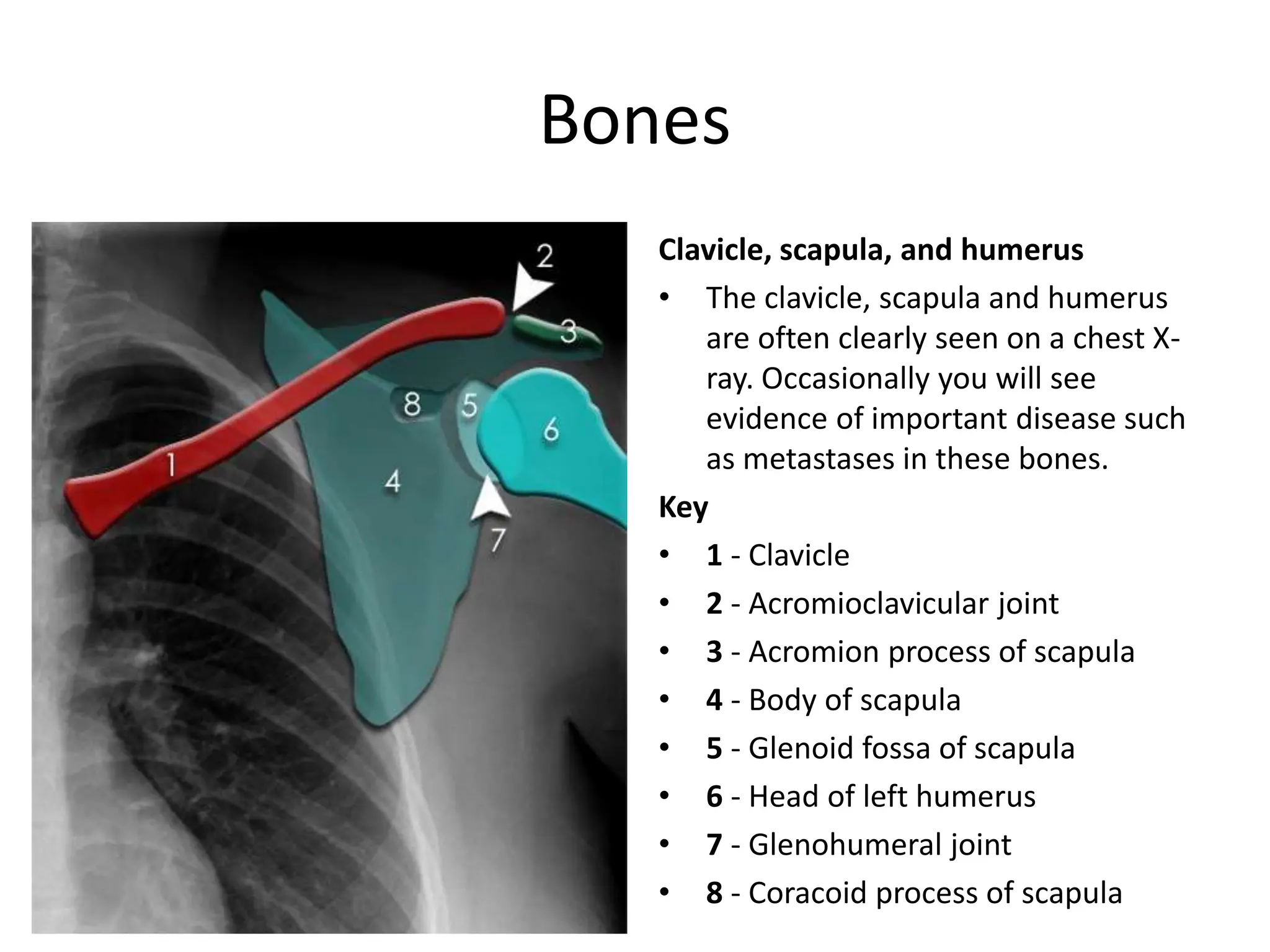 Chest X-Ray Anatomy. | PPTX