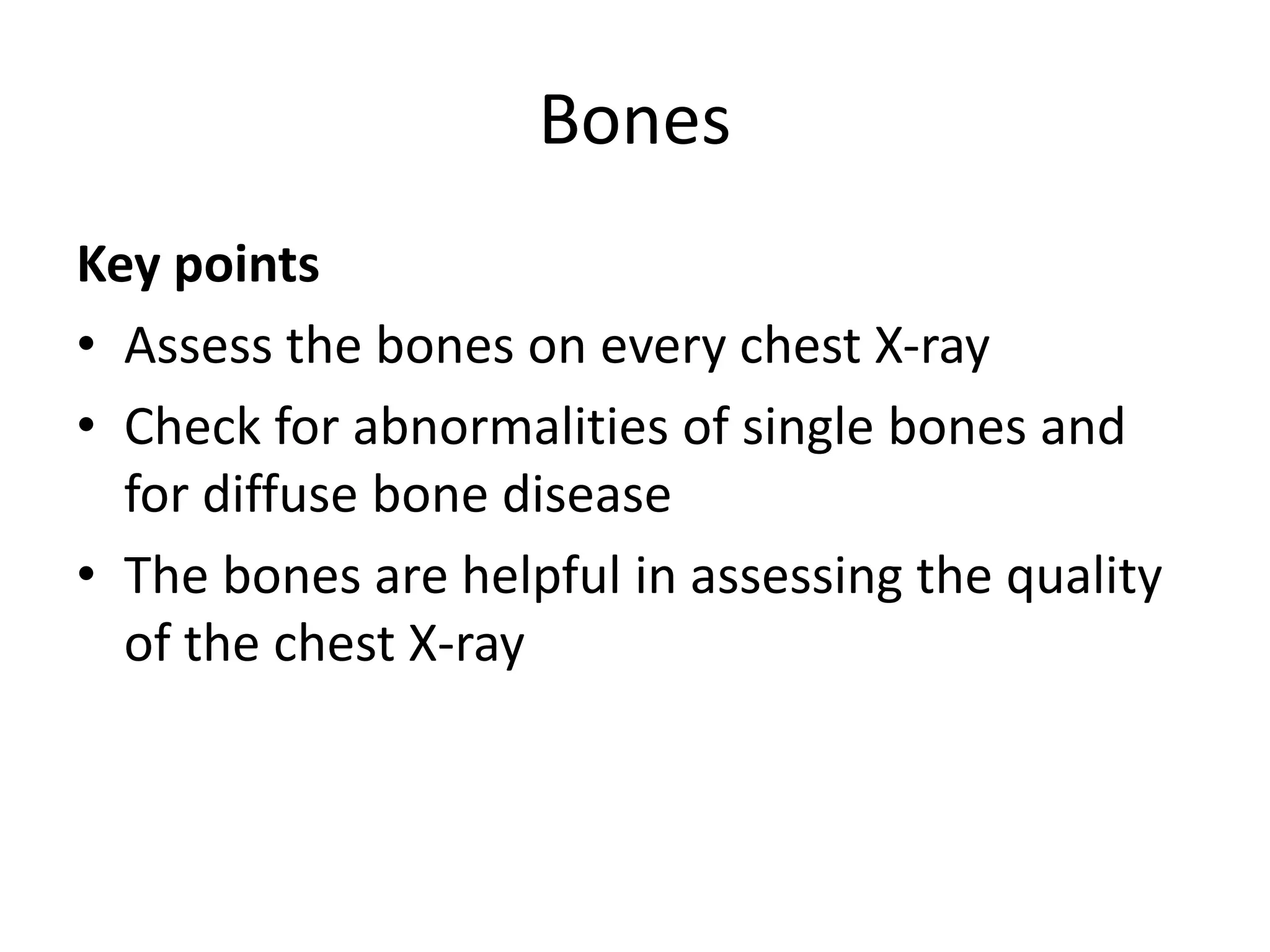 Chest X-Ray Anatomy. | PPTX