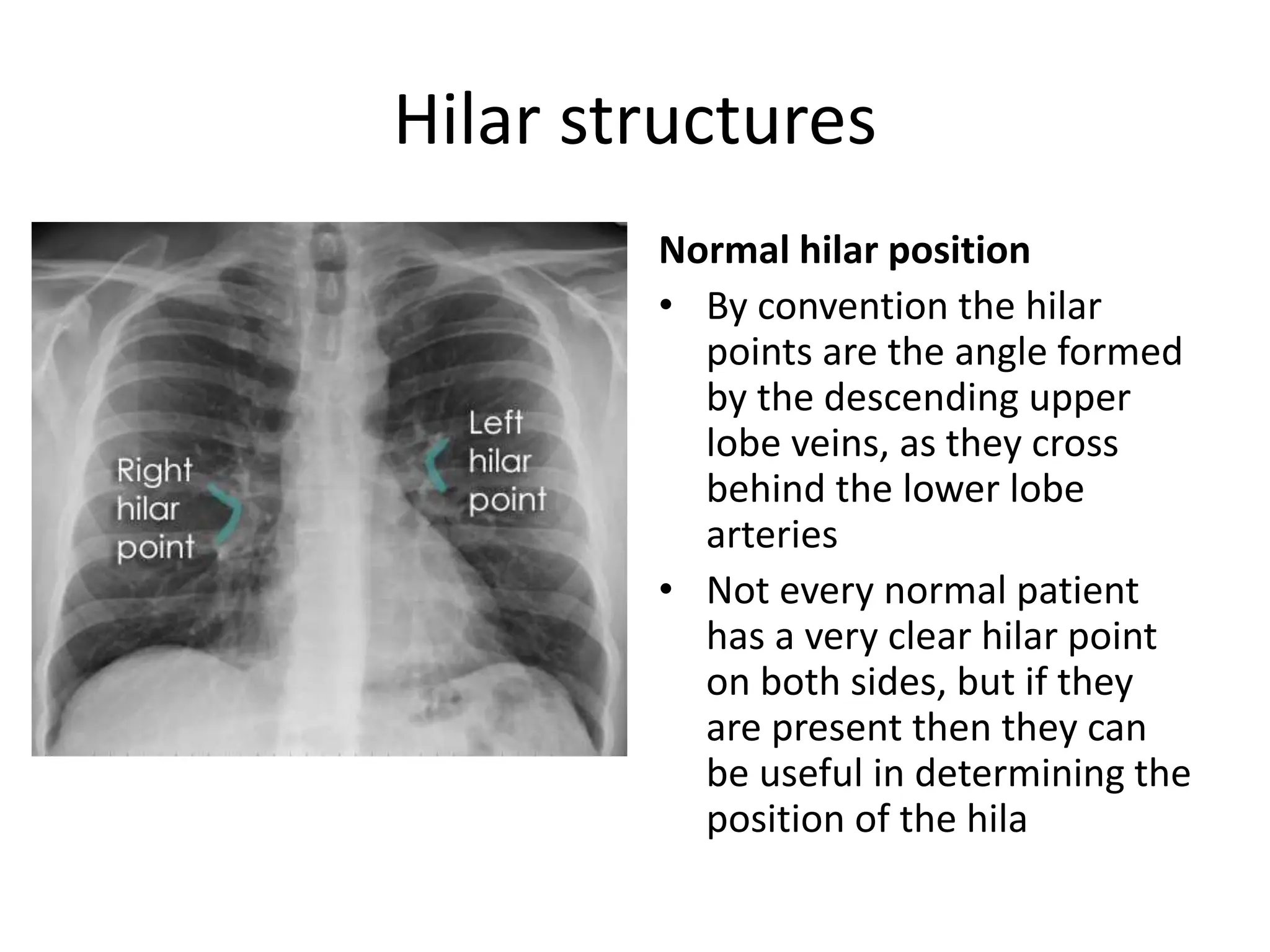 Chest X-Ray Anatomy. | PPTX