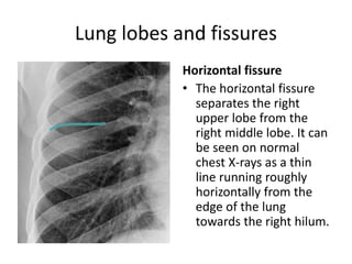 Chest X-Ray Anatomy. | PPTX