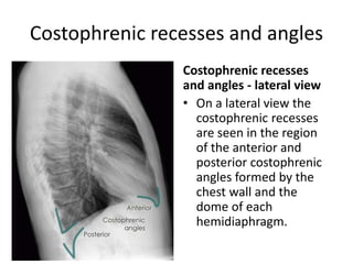 Chest X-Ray Anatomy. | PPTX