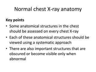 Chest X-Ray Anatomy. | PPTX