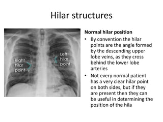 Chest X-Ray Anatomy. | PPTX