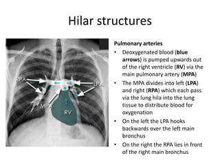 Chest X-Ray Anatomy. | PPTX