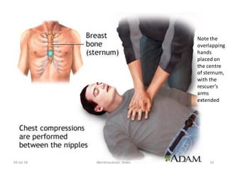 Cardio pulmonary resuscitation (CPR) | PDF