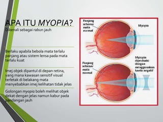 KAJIAN KES PERBANDINGAN PENGARUH BAKA DAN PERSEKITARAN | PPTX