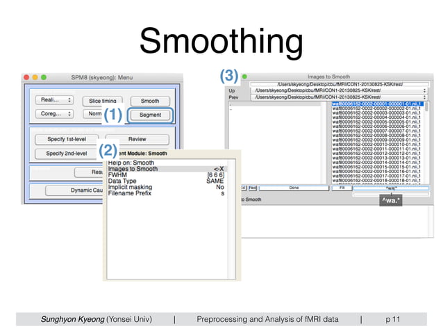 fMRI preprocessing steps (in SPM8) | PDF | Science