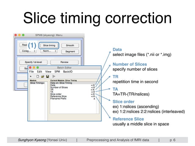 fMRI preprocessing steps (in SPM8) | PDF | Science