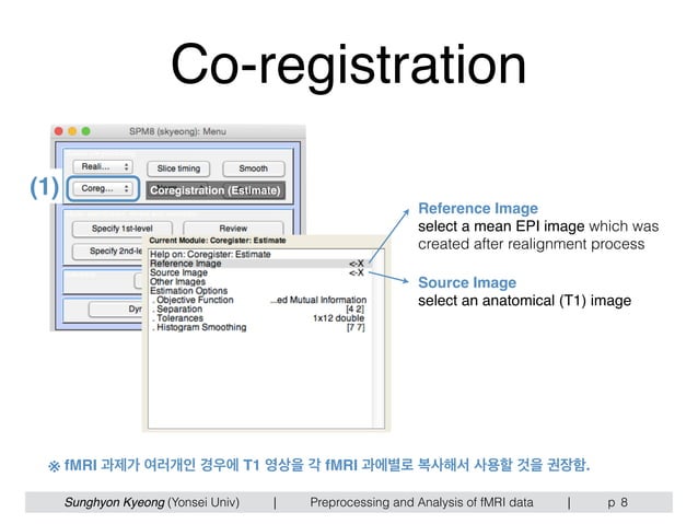 fMRI preprocessing steps (in SPM8) | PDF | Science
