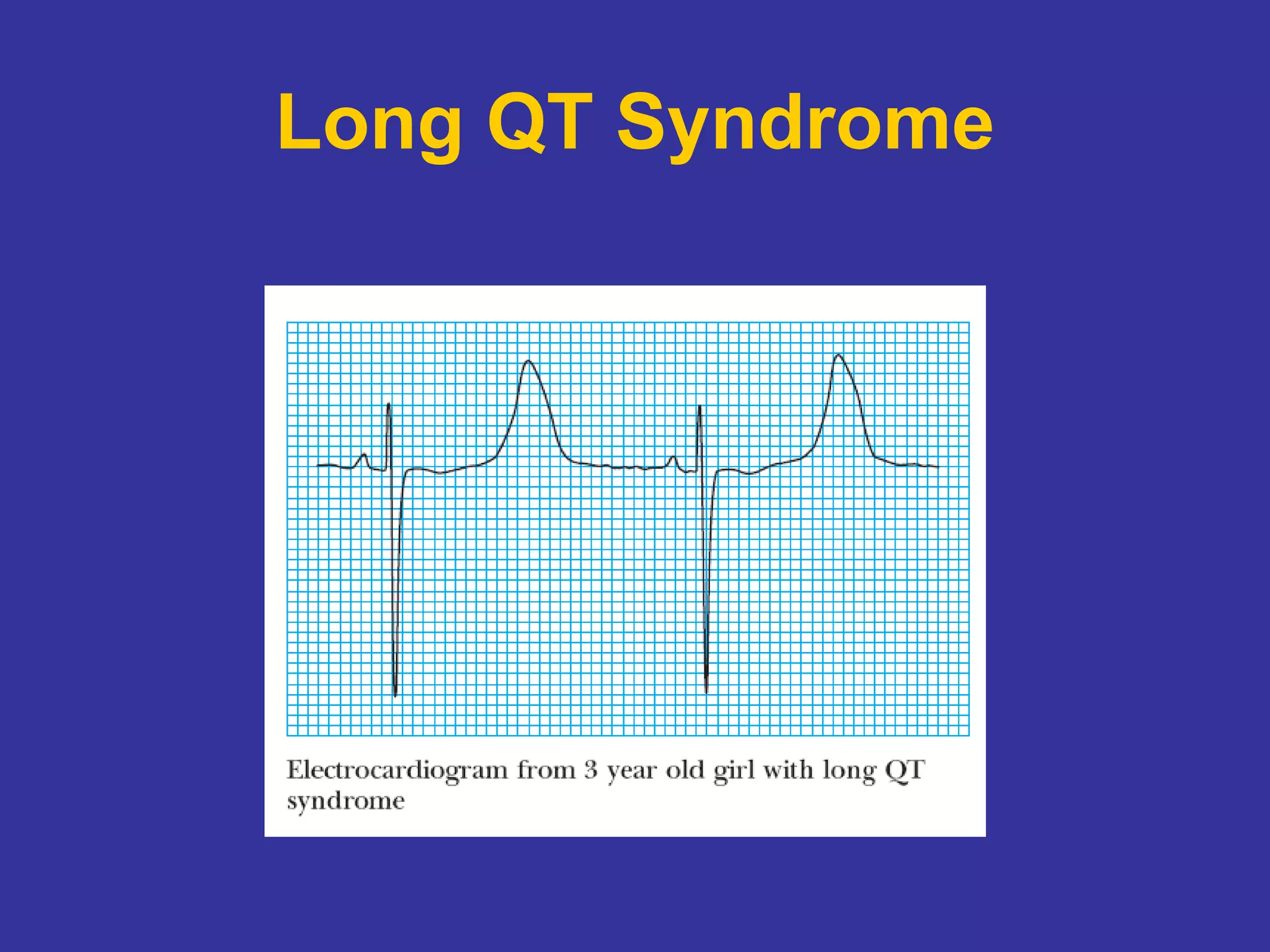 Tutorial in Basic ECG for Medical Students | PPT