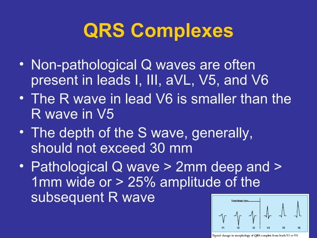 Tutorial in Basic ECG for Medical Students | PPT | Heart and ...