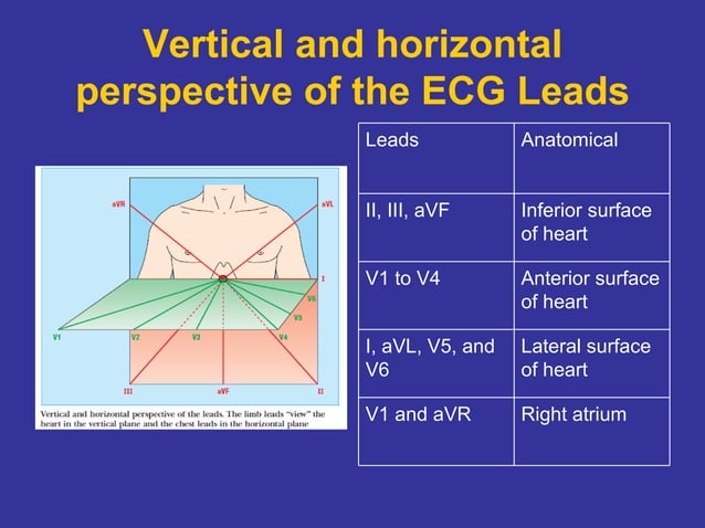 Tutorial in Basic ECG for Medical Students | PPT | Heart and ...