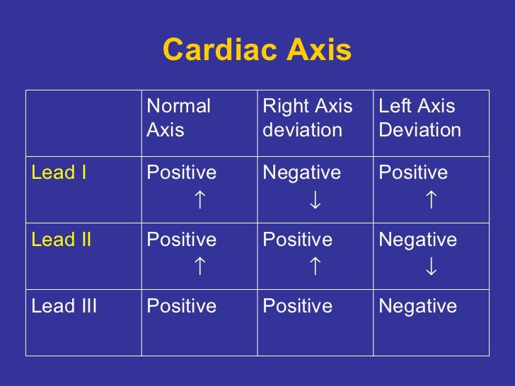 Tutorial in Basic ECG for Medical Students