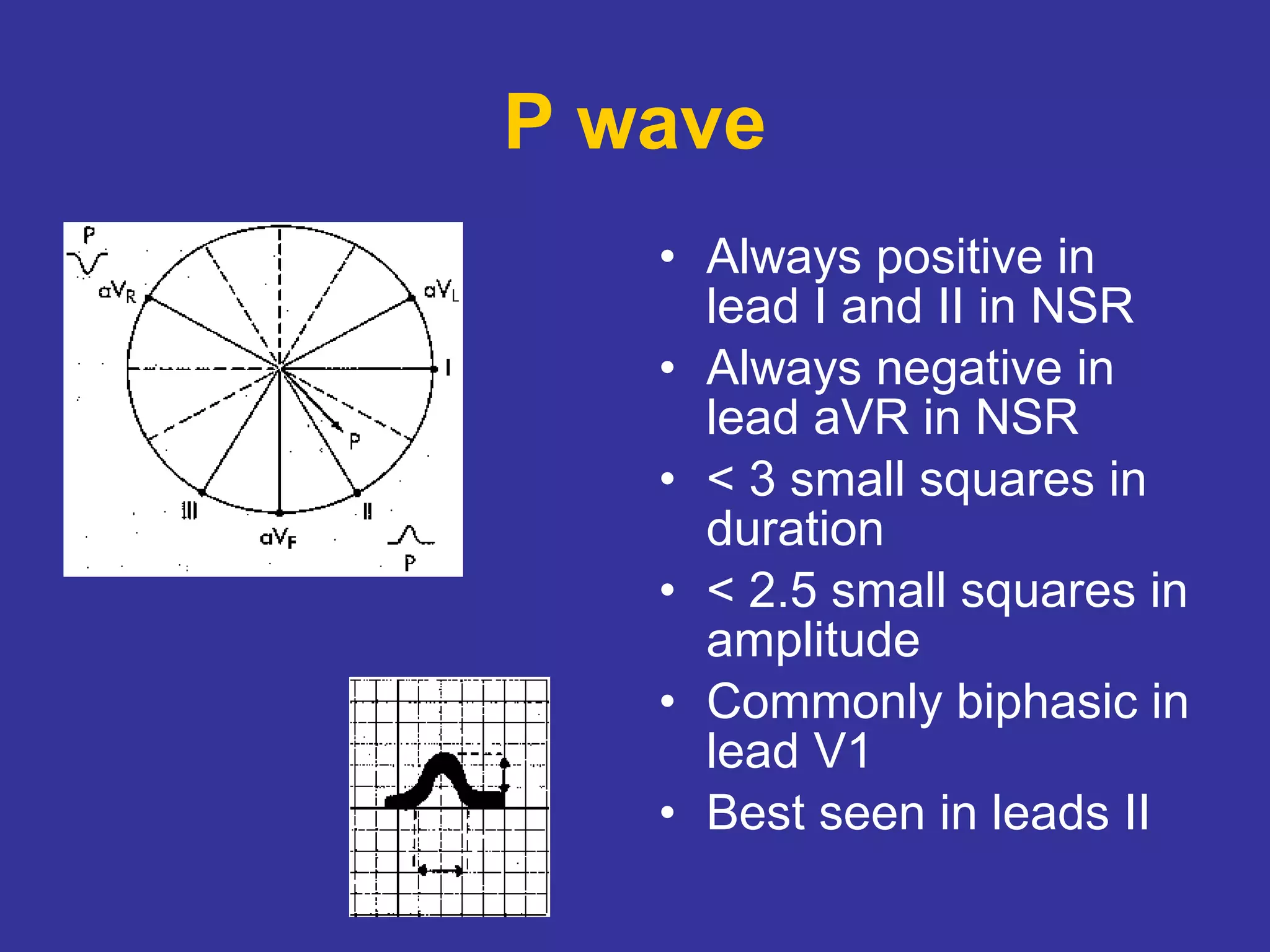 Tutorial in ecg | PPT