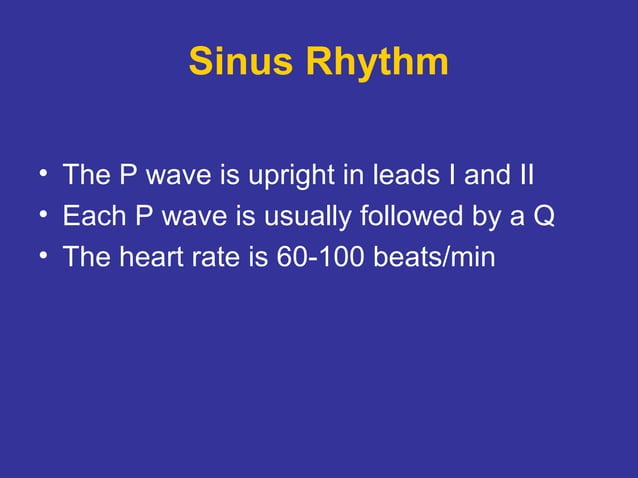 Tutorial in ecg | PPT