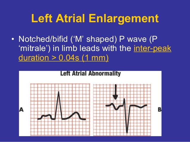 Tutorial in ecg