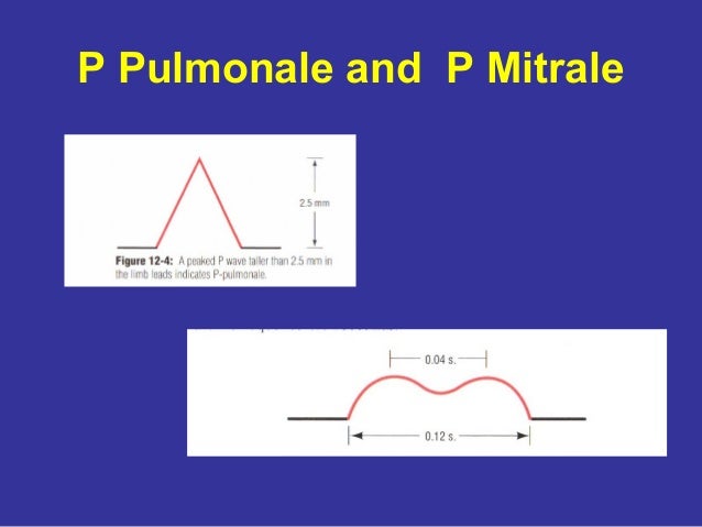 Tutorial in ecg