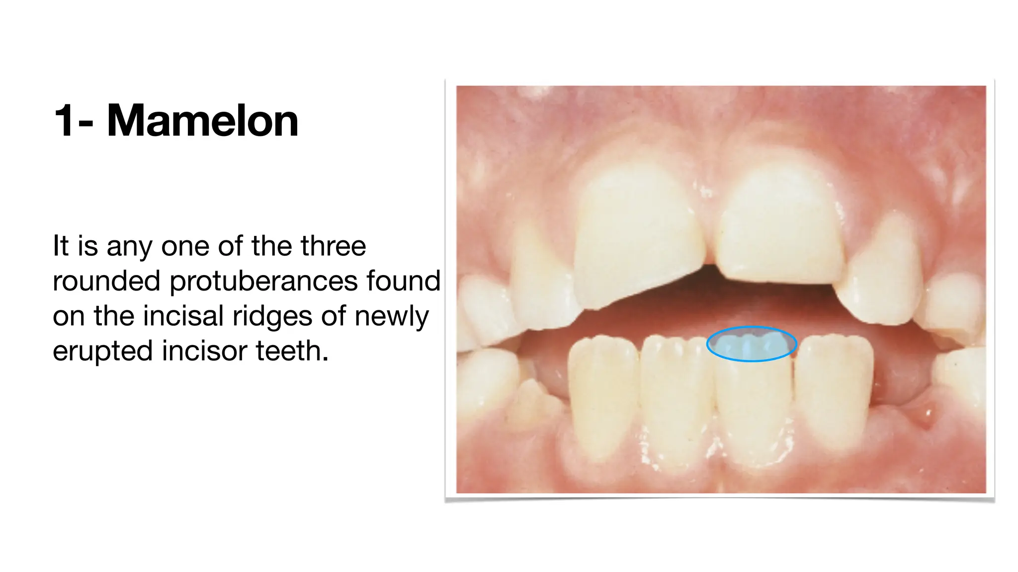 Tutorial, Lecture 3.pdf