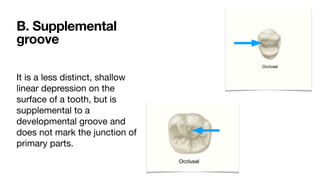 Tutorial, Lecture 3.pdf