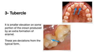 Tutorial, Lecture 3.pdf