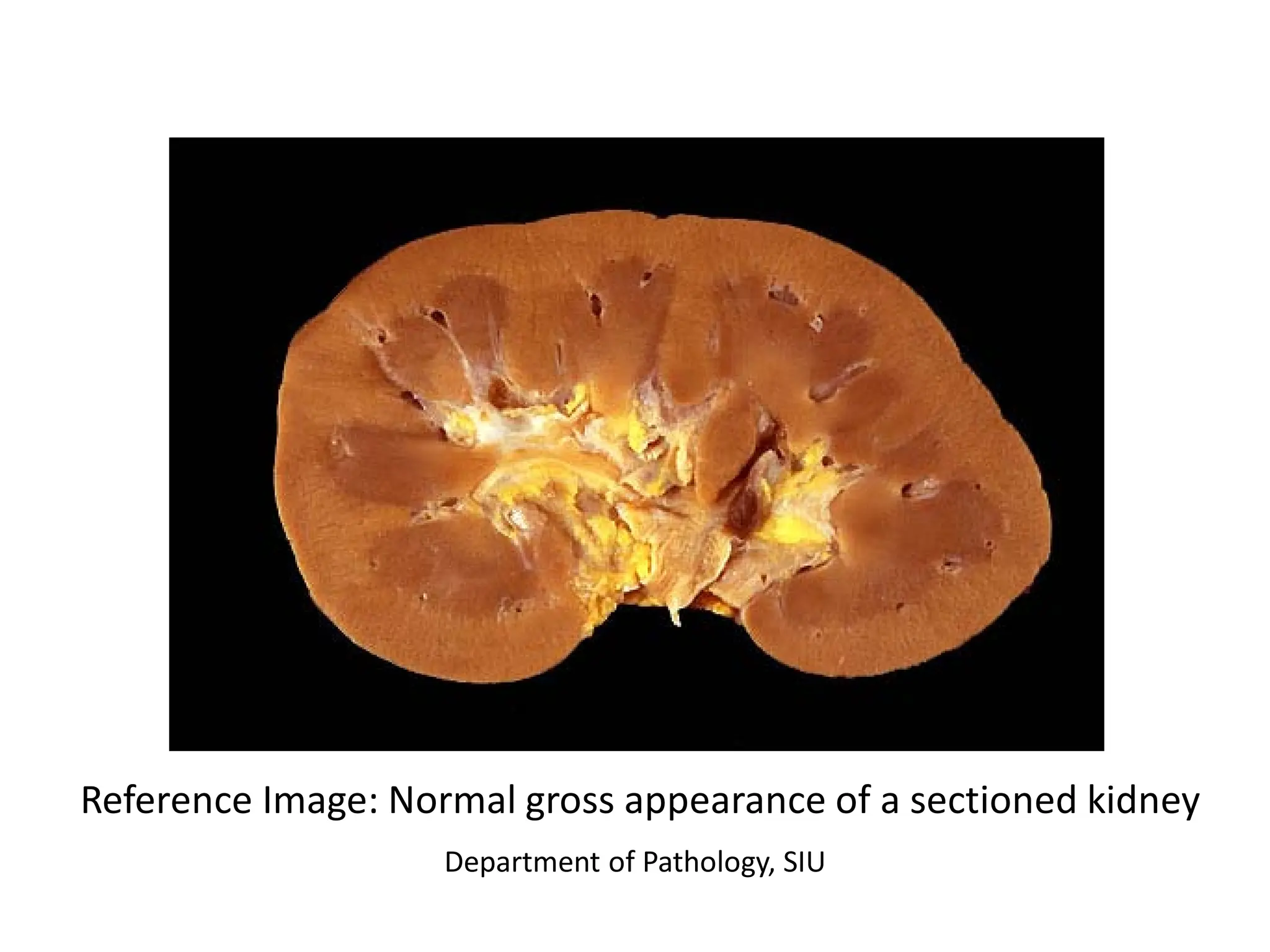 Urinary system Tutorial Renal Pathology.pdf