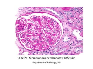 Urinary system Tutorial Renal Pathology.pdf